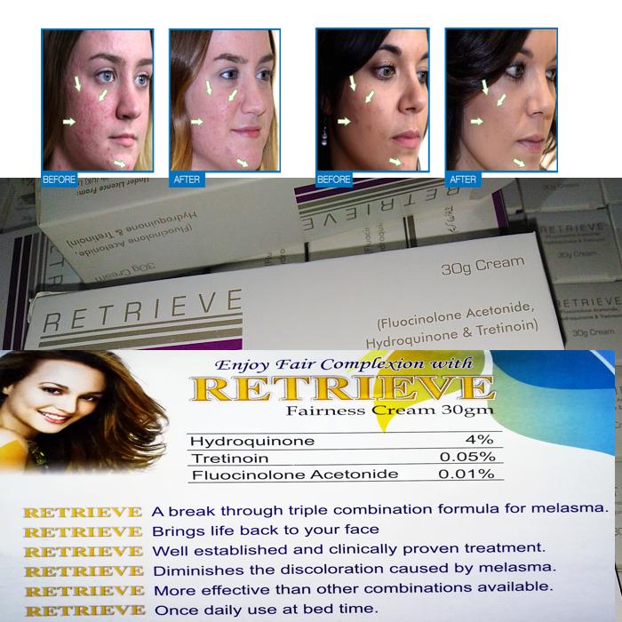 ReTrieve Cream Tretinoin Topical Cream 30 grams | Daraz.pk