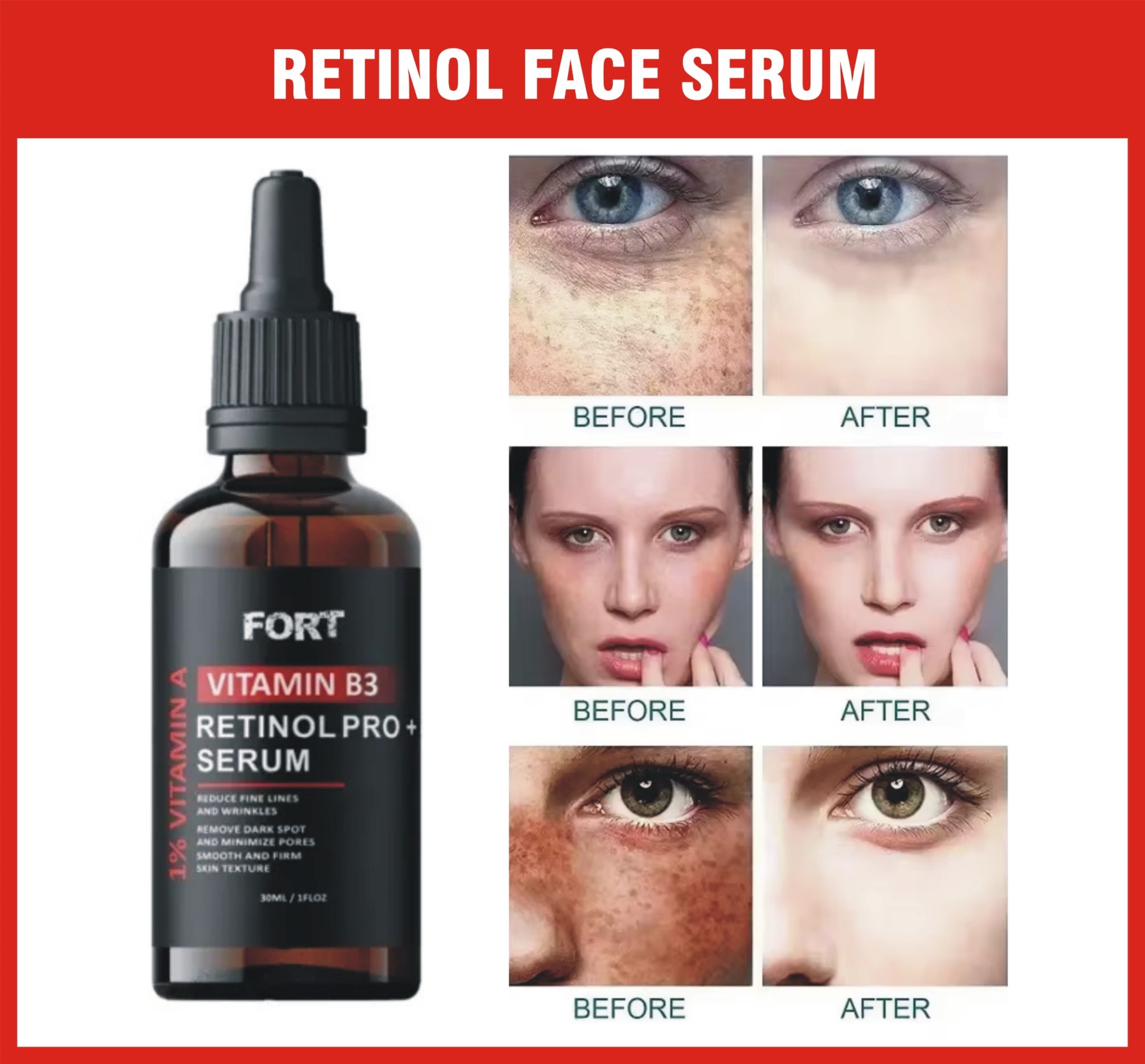 Fort 1 % Retinol Face Serum Anti Aging Face Serum for Lines, Wrinkles ...