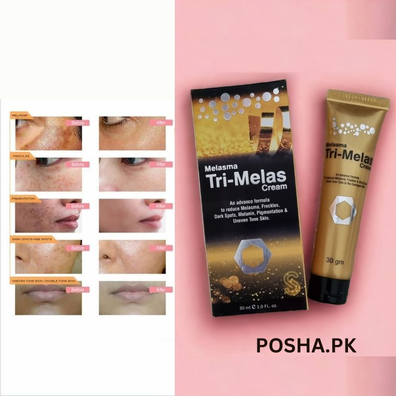 Dr.Romia Tri Melas Cream Remove Melasma & Freckles - 30g | Daraz.pk