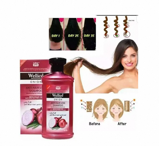 Wellice Onion Anti Hair Loss Shampoo 400ml | Daraz.pk