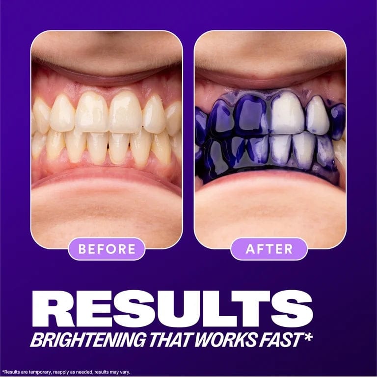 HiSmile V34 Purple Whitening Toothpaste – Hi Smile Original Color ...