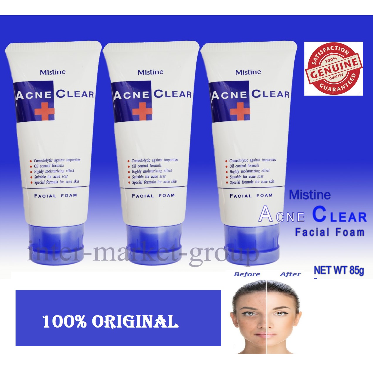 Mistine Acne Clear Face Wash Facial Foam 85 ml (Pack of 3) | Daraz.pk