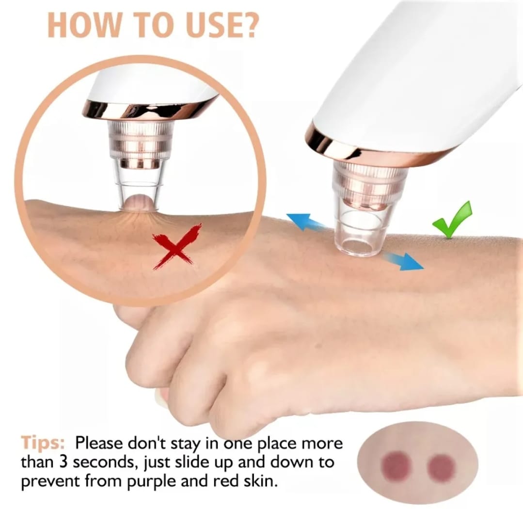 5 in 1 Multifunction Blackhead Removal Rechargeable Machine | White ...