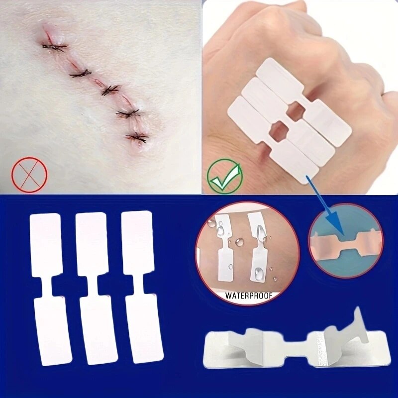 5Pcs Outdoor Wound Adhesive Tape Disposable First Aid Wound Suture ...