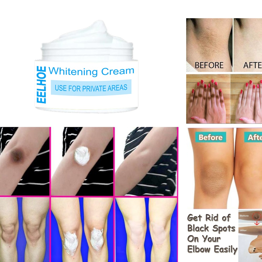 Aveessence Eelhoe Whitening Cream for Private Parts - Sensitive Areas ...