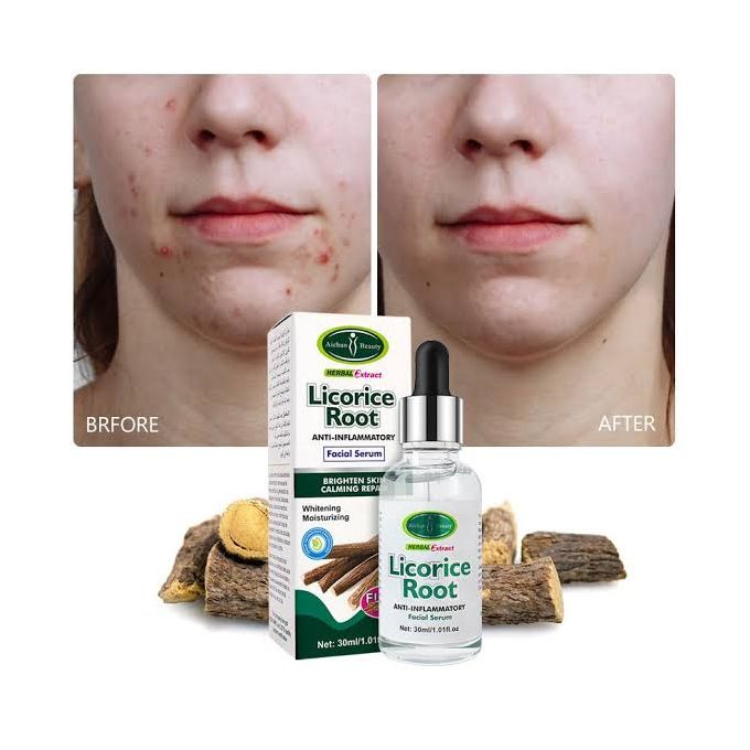 Herbal Licorice Root Anti Inflammatory Facial Whitening Serum 30ml ...