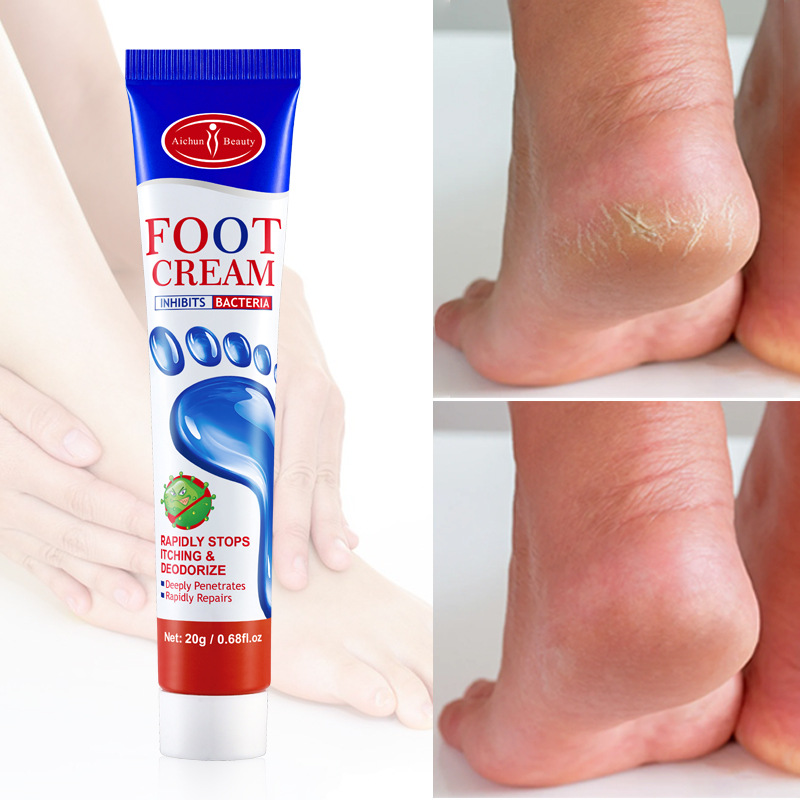 Cross-Border Aichun Foot Cream Foot Protection Suit Foot Odor Foot ...