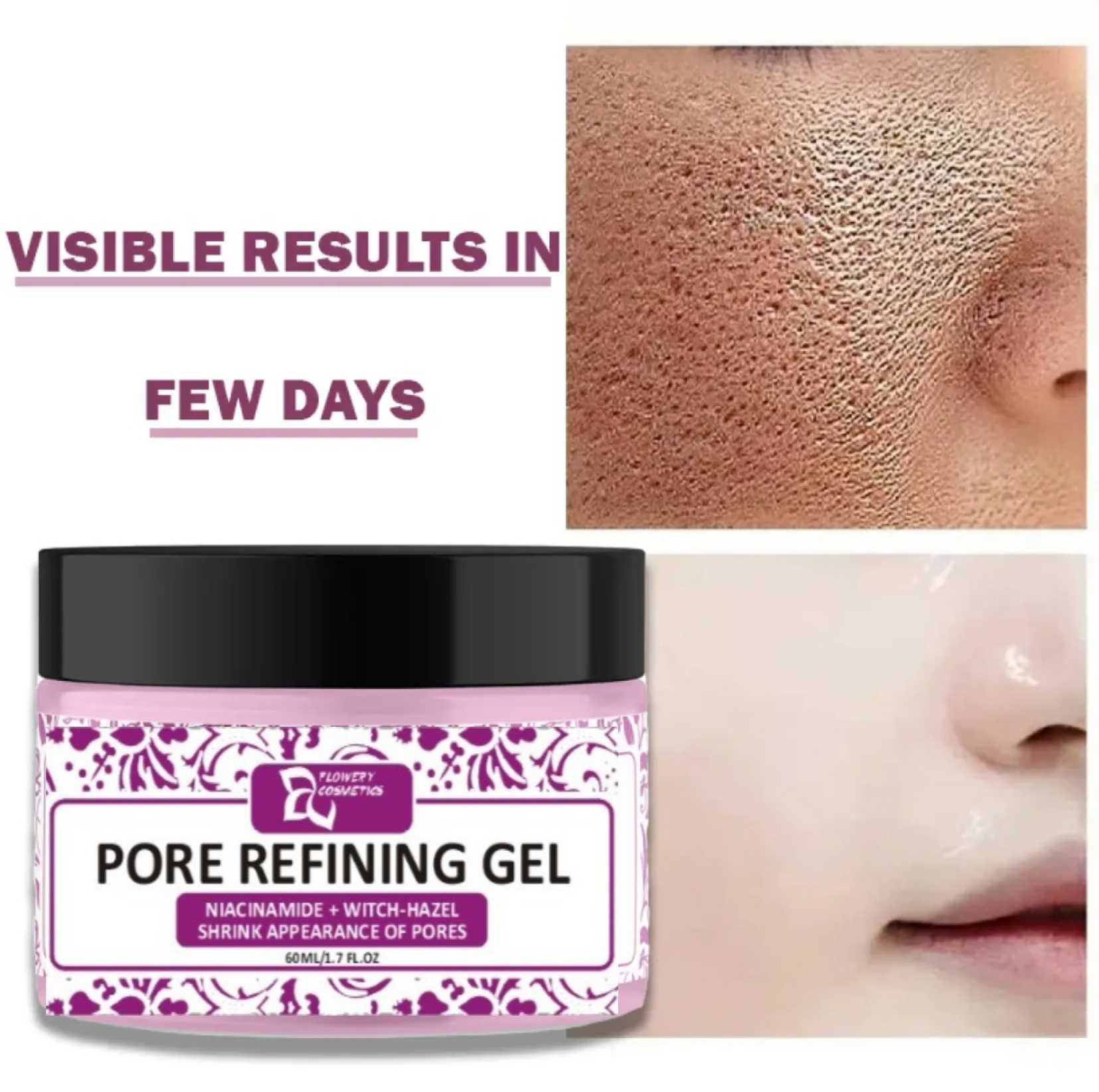 Flowery Pore-Refining Treatment Gel (Niacinamide + Witch-hazel) - 50g ...