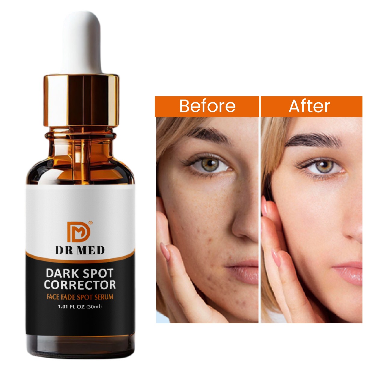 Dark Spot serum (Face Fade serum) Niacinamide 10% 30ml | Daraz.pk