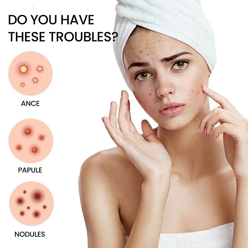 Repair Acne Patch Facial Skin Care Fade Blemishes Pimple Marks Closed ...