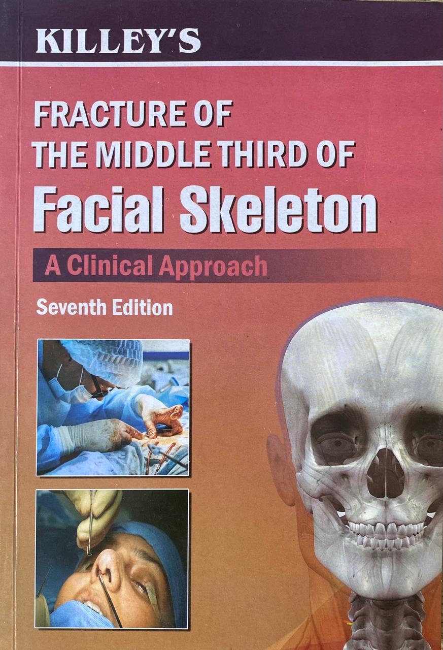 Killey”s Fractures of the midddle Third Of The Faicial Skeleton And ...